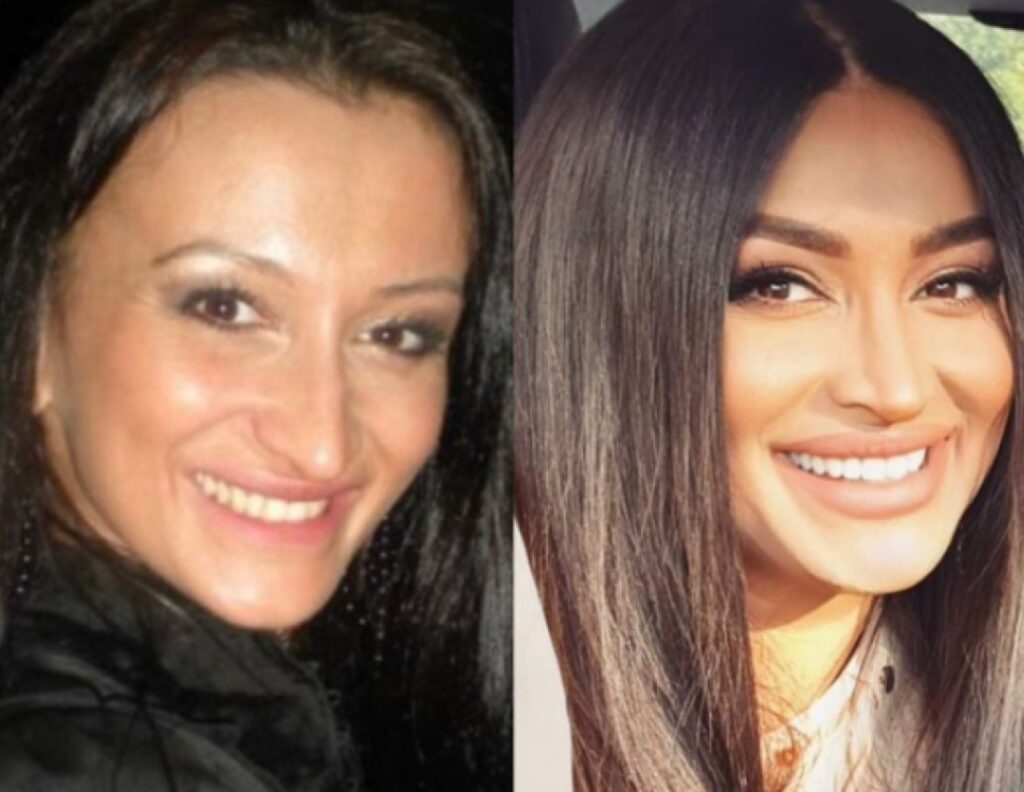 Dosta se promijenila: Isplivala fotka Andreane Čekić prije estetskih ...