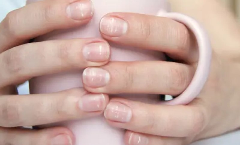 Česta pojava koja može da zabrine ljude: Evo šta predstavljaju bijele ...